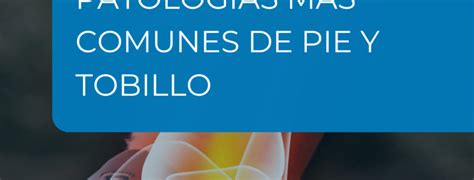 Conoce diez de las patologías más comunes de pie y tobillo icatpie