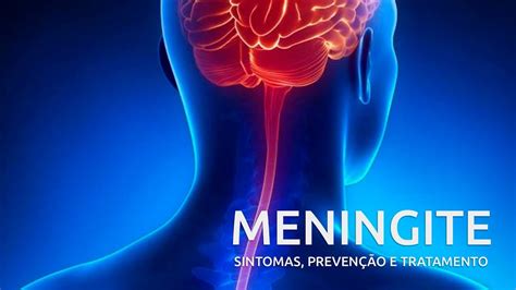 Meningite sintomas prevenção e tratamento Sua Saúde na Rede YouTube