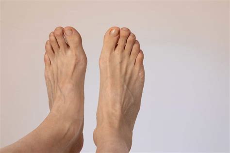 Extensor Tendonitis