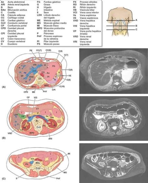 Resonancia Magnética Abdominal Resobert Medicina Radiología