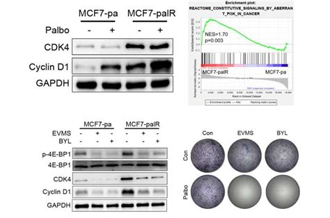 Overexpressed Cyclin D1 And CDK4 Proteins Are Responsible For The