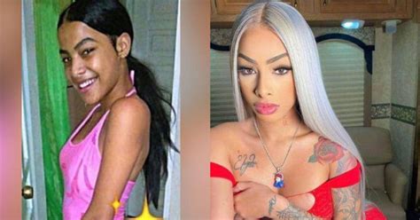 El Antes Y Despu S De Yailin La M S Viral Tras Someterse A Cirug As