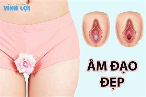 Âm đạo đẹp là như thế nào Cách để có cô bé xinh xắn hồng hào