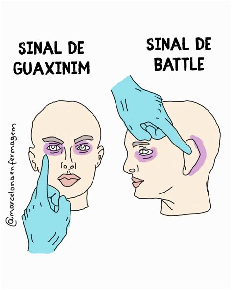 Sinal De Guaxinim Tce
