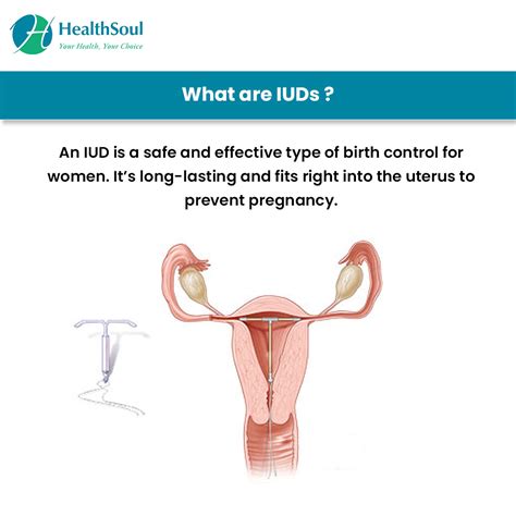DIAGRAM Cervix Diagram Iud MYDIAGRAM ONLINE