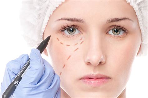 Oculoplastic Surgery For Under Eye Bags And Puffiness SightMD
