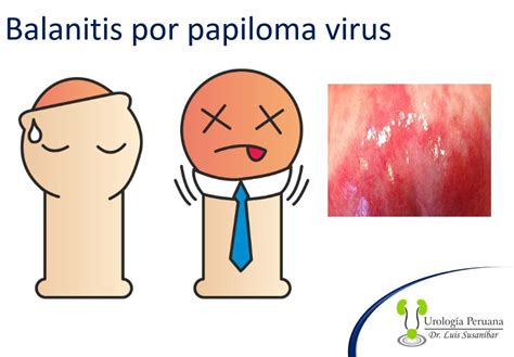 Urología Peruana Dr Susaníbar