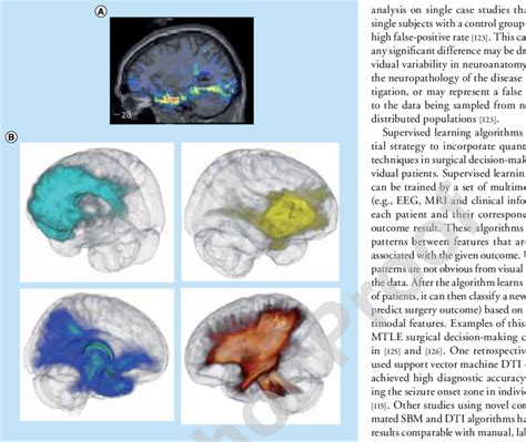 diffusion tensor imaging for imaging structural connectivity a download scientific diagram