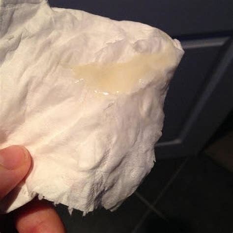 Mucus Plug Pictures Real Photos Of Mucus Plugs Sunshine
