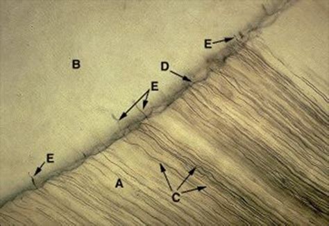 Enamel Spindles At The Dej Diagram Quizlet