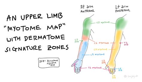 Myotomes And Dermatomes Map