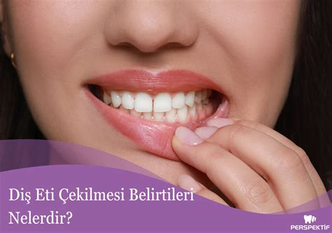 Di Eti Ekilmesi Belirtileri Nelerdir Perspektif A Z Ve Di
