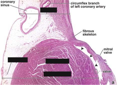 Cardiovascular Histology Flashcards Quizlet