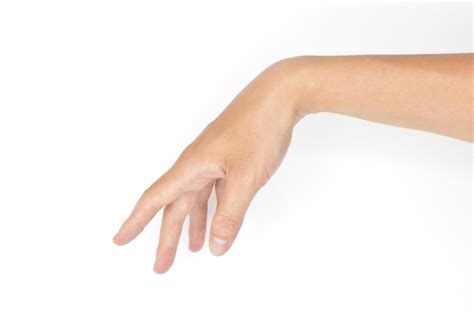 Premium Photo Radial Nerve Injury Or Wrist Drop