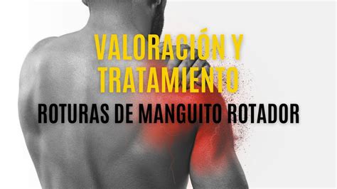 Dolor De Hombro Por Rotura Manguito Rotador Qu Hacer Youtube