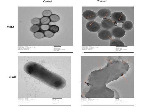 Transmission Electron Micrograph Of MRSA And E Coli Grown In The