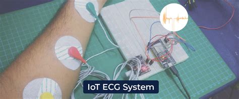 Build An Iot Ecg Electrocardiogram System With An Ad Esp To