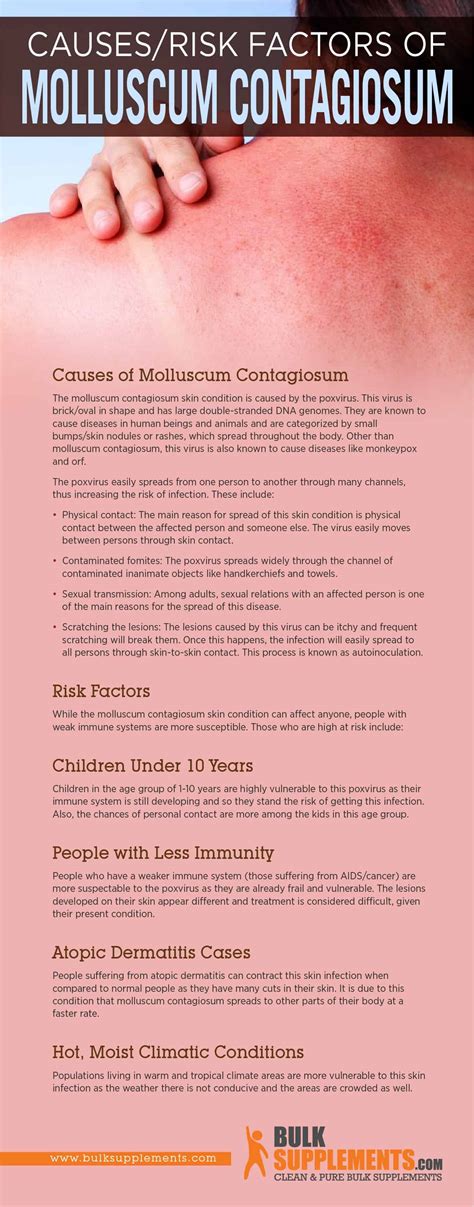 Molluscum Contagiosum Symptoms Causes Treatment