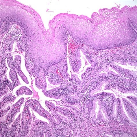 Endocervix Histology
