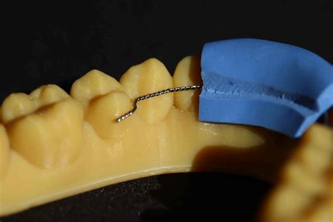 Primo une large gamme de contentions orthodontiques numériques