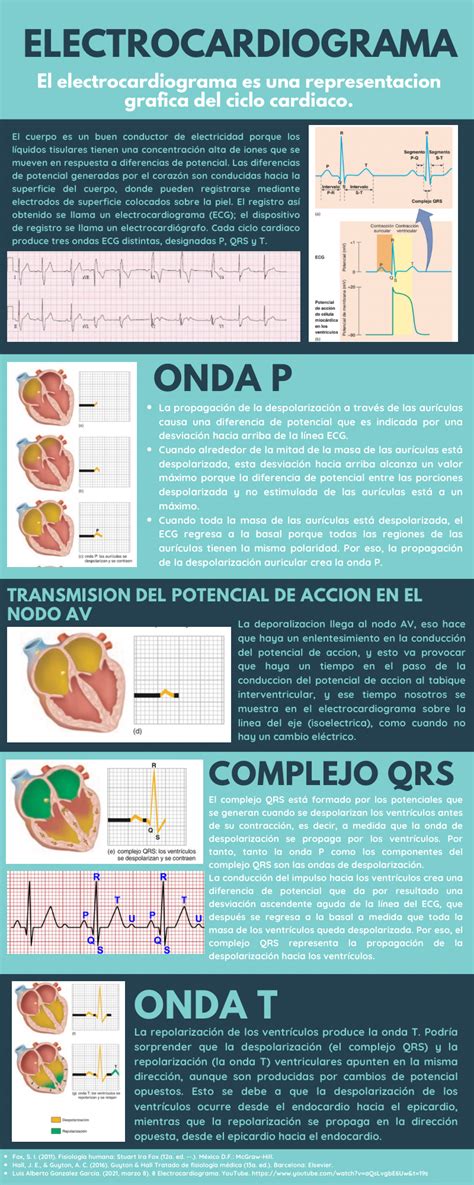 ELECTROCARDIOGRAMA