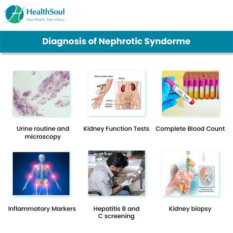 Nephrotic Syndrome Symptoms And Treatment Nephrology HealthSoul