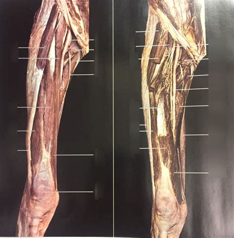 Thigh Cadaver Diagram Quizlet
