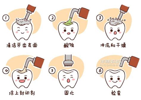 7局部用氟预防龋齿