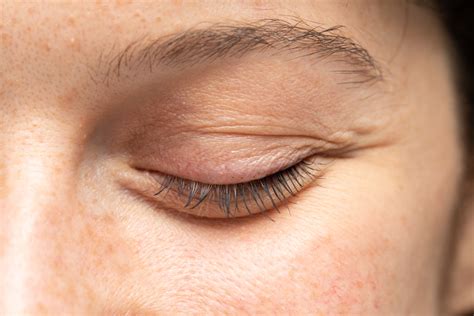8 Astuces Pour Lutter Contre Les Cernes Au Naturel