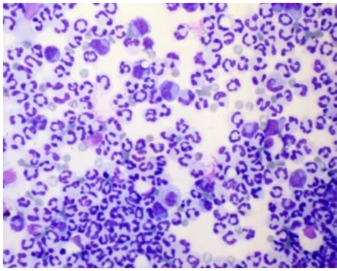 Clinpath Cytology Flashcards Quizlet