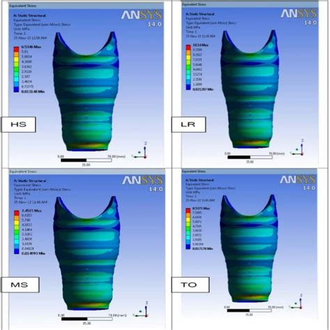 design optimization and comparative stress analysis of connecting rod using finite element analysis