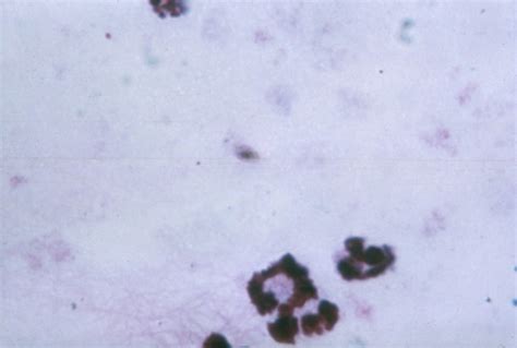 Free Picture Thick Film Photomicrograph Shows Plasmodium