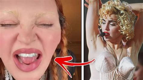 Madonna Ruined Her Career With Plastic Surgery Youtube