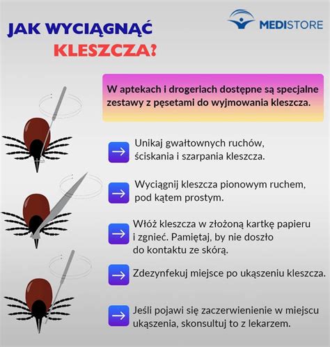 Jak usunąć kleszcza Infografika