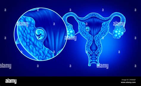 Implanted Human Embryo Concept And Successful Pregnancy Implantation In