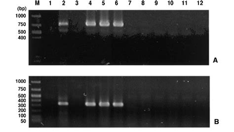 Agarose Gel Electrophoresis Of Rt Pcr Products A Rt Pcr Products For