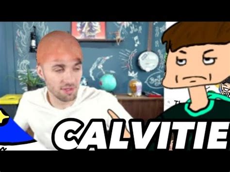 Pourquoi SQUEEZIE A La Plus Grosse Calvitie De France YouTube