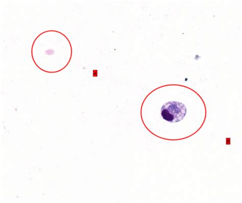 Fluid Cytology Flashcards Quizlet