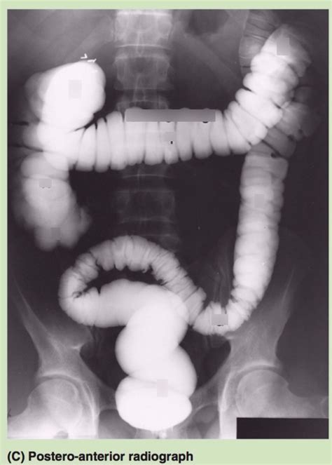 Abdominal Radiograph Diagram Quizlet