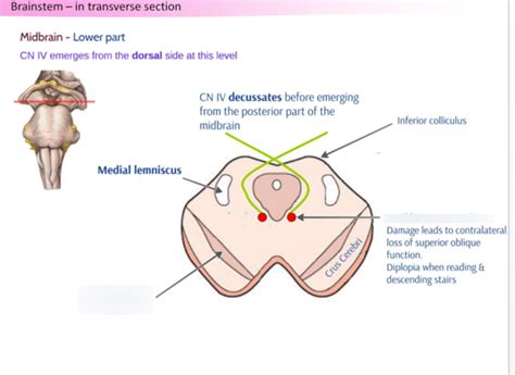Transverse Section Midbrain Lower Diagram Quizlet