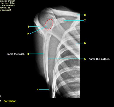 Scapula Lateral View Diagram Quizlet