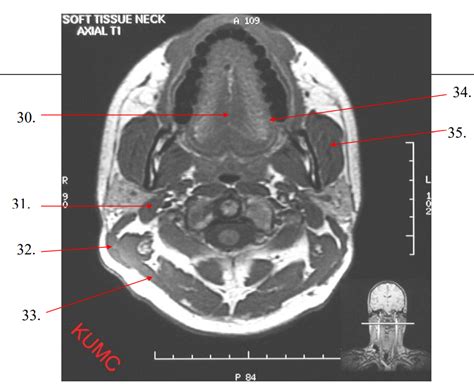 Mri Axial Diagram Quizlet