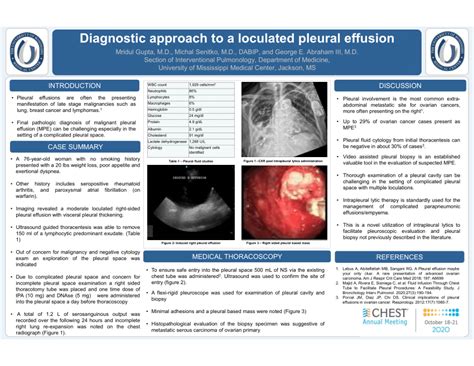 PDF A DIAGNOSTIC APPROACH TO A LOCULATED PLEURAL EFFUSION