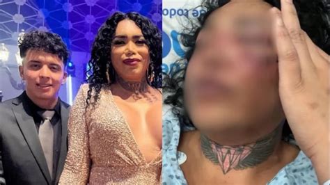 Su Novio La Golpe Paola Su Rez De Las Perdidas Es Hospitalizada