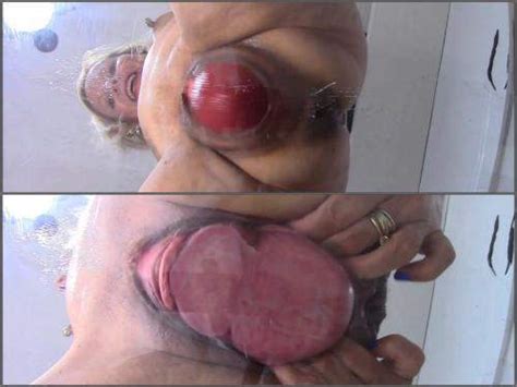 Raisawetsx Huge Ball Penetration In Pussy Prolapse Premium User