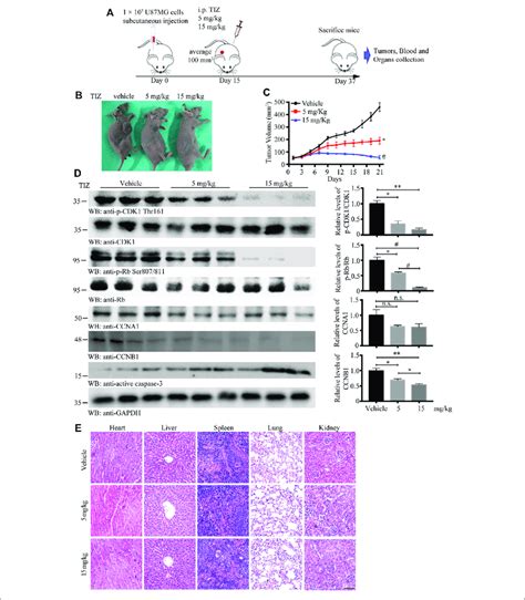 Tiz Inhibits Gbm Growth In A Subcutaneous Xenograft Nude Mouse Model