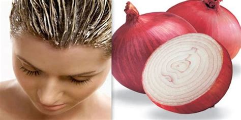 Arriba Imagen Recetas Caseras Para Hacer Crecer El Pelo Mas Rapido