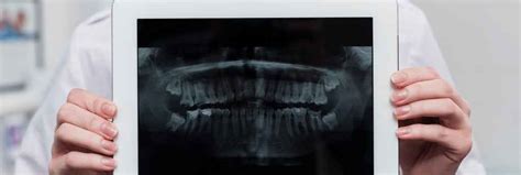 Radiografia Odontológica guia completo sobre tipos e benefícios