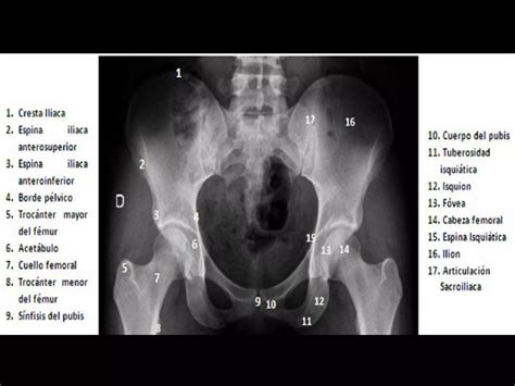 Ppt Anatomia Radiologica Del Abdomen Y Pelvis PPT