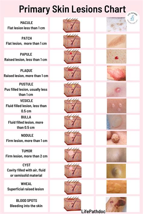 Skin Lesions Types With Chart Pictures Causes Treatment